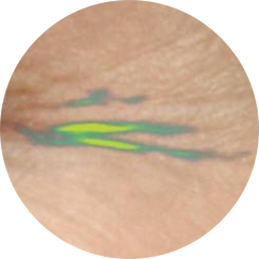 Find your ideal skincare solution with Skin Screen | Lancôme