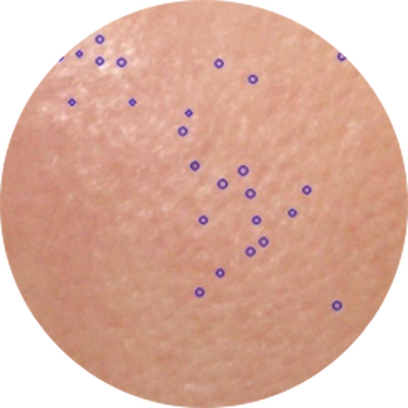 Find your ideal skincare solution with Skin Screen | Lancôme