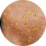 New Skin Screen for Most Advanced Skin Analysis | Lancôme